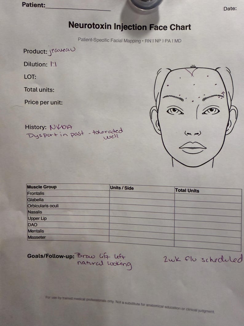 Neurotoxin Injection Face Chart | Patient Facial Mapping PDF | Botox ...