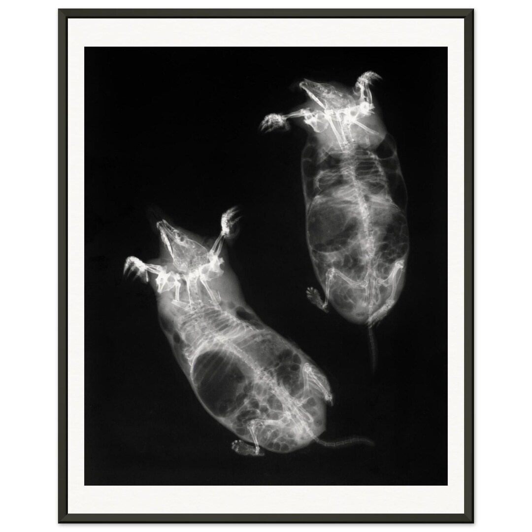 Impresión de rayos X de lunares / Póster con marco metálico en papel ...