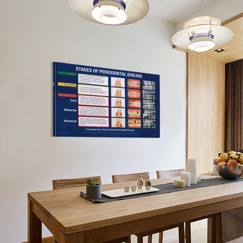 Periodontal Disease Stages Canvas Poster, Dental Clinic Wall Art - Etsy