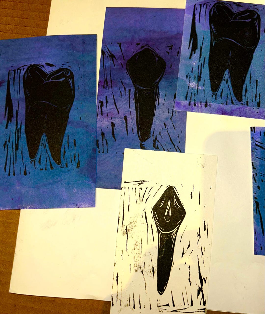 Tooth Art Print: Signed Molar, Premolar, Canine - Etsy