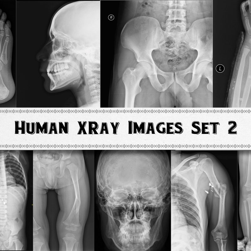 X Ray App Download Free - Etsy Australia