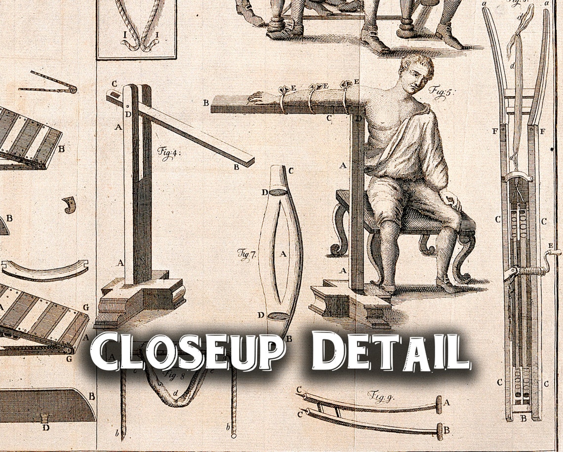 Surgical Instrument Chart Images / Vintage Medical / Digital | Etsy