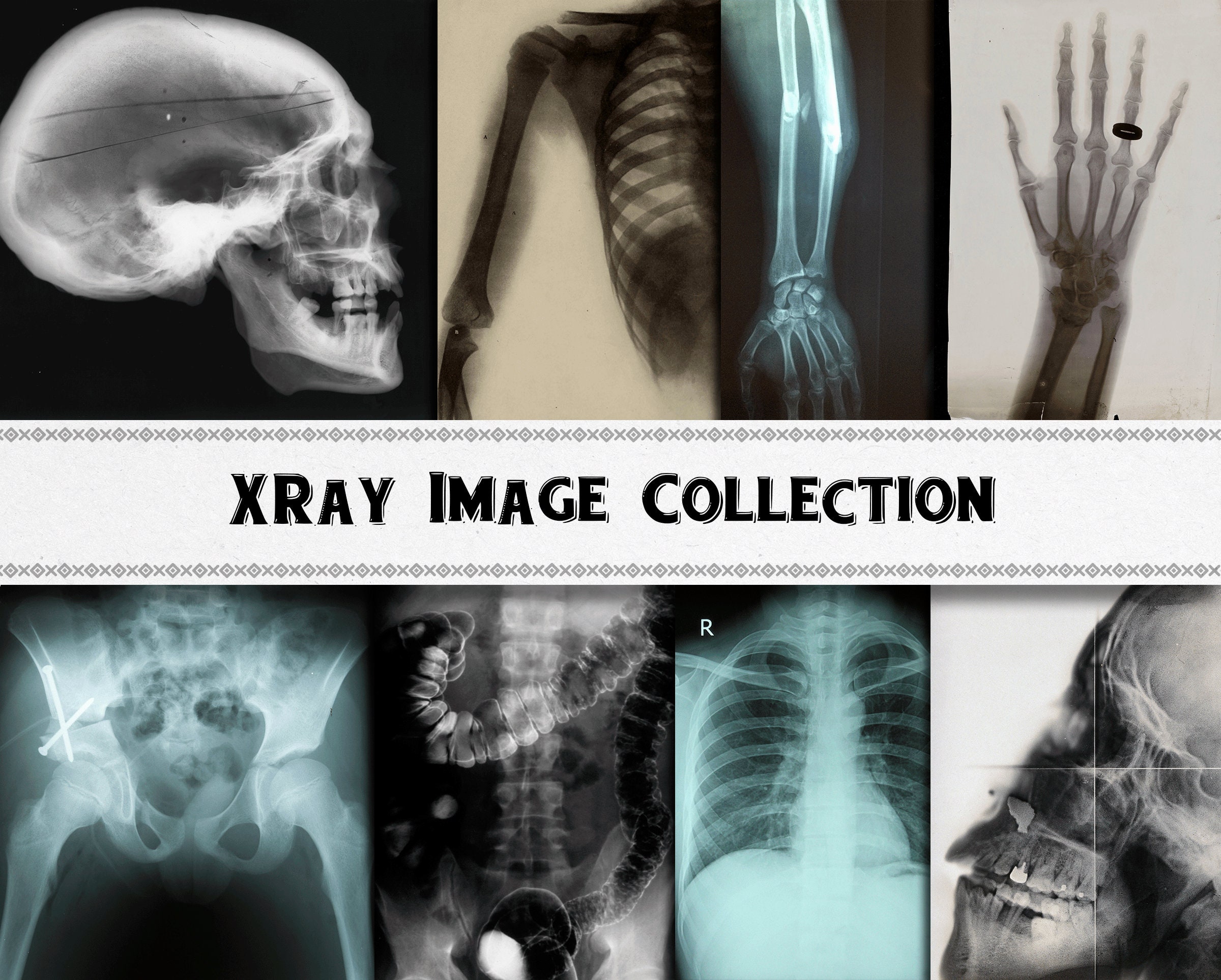 Printable X Ray Pictures For Kids