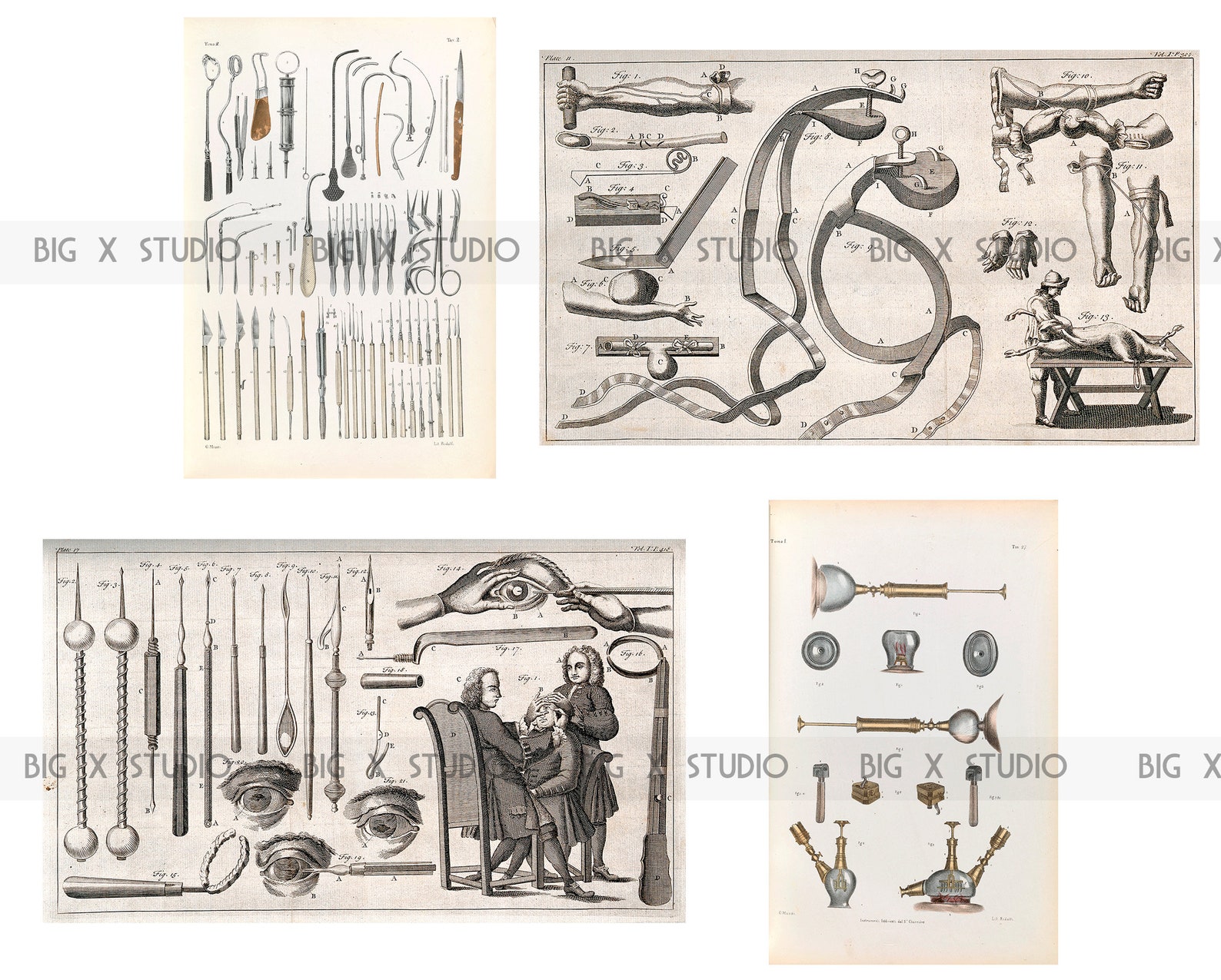 Surgical Instrument Chart Images / Vintage Medical / Digital - Etsy