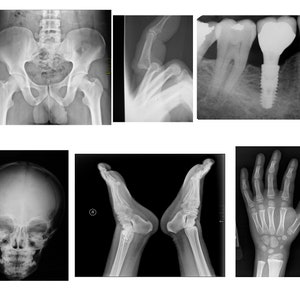 X-ray Images Set 2 / Medical Graphics / Digital Download / Commercial ...