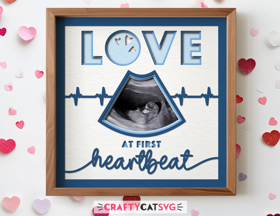 Baby Ultrasound Shadow Box SVG File for Cricut Projects, Ultrasound ...