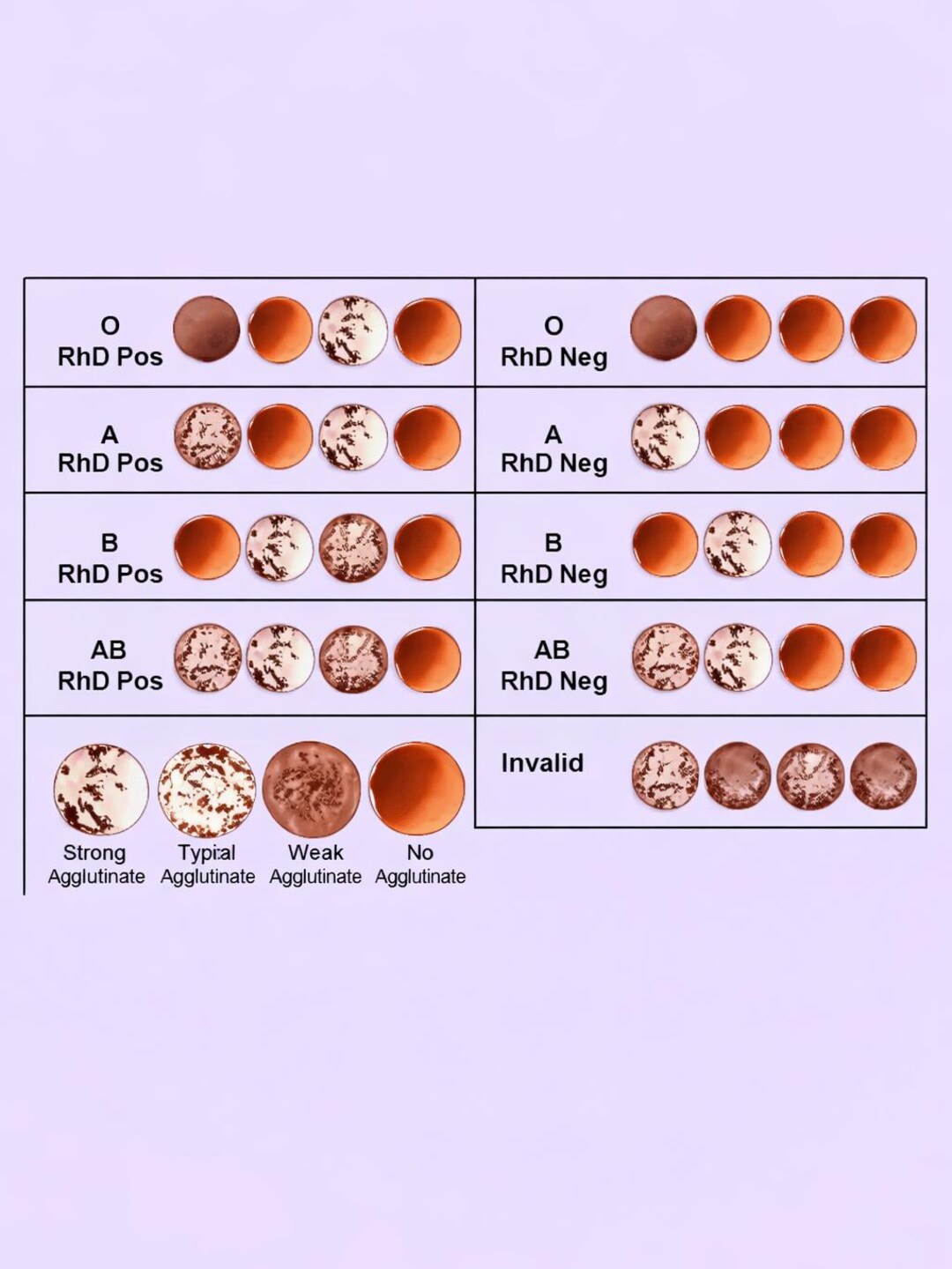 Blood Typing Test Kit - Etsy Australia