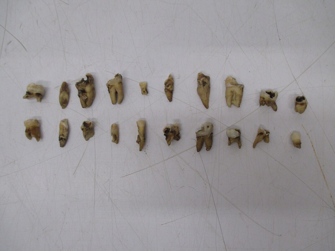 Lot 20 Assorted Human Tooth Teeth Extracted Vintage Dental Research ...