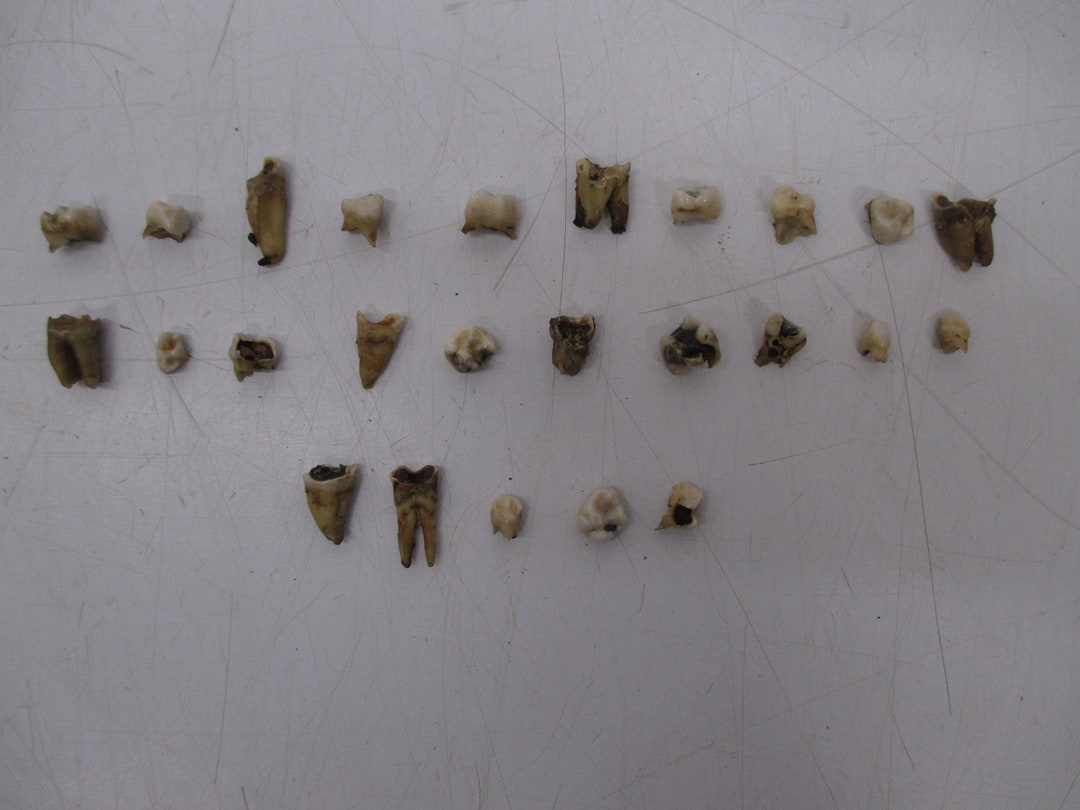 Lot 25 Assorted Human Tooth Teeth Extracted Fragments Crowns Vintage ...