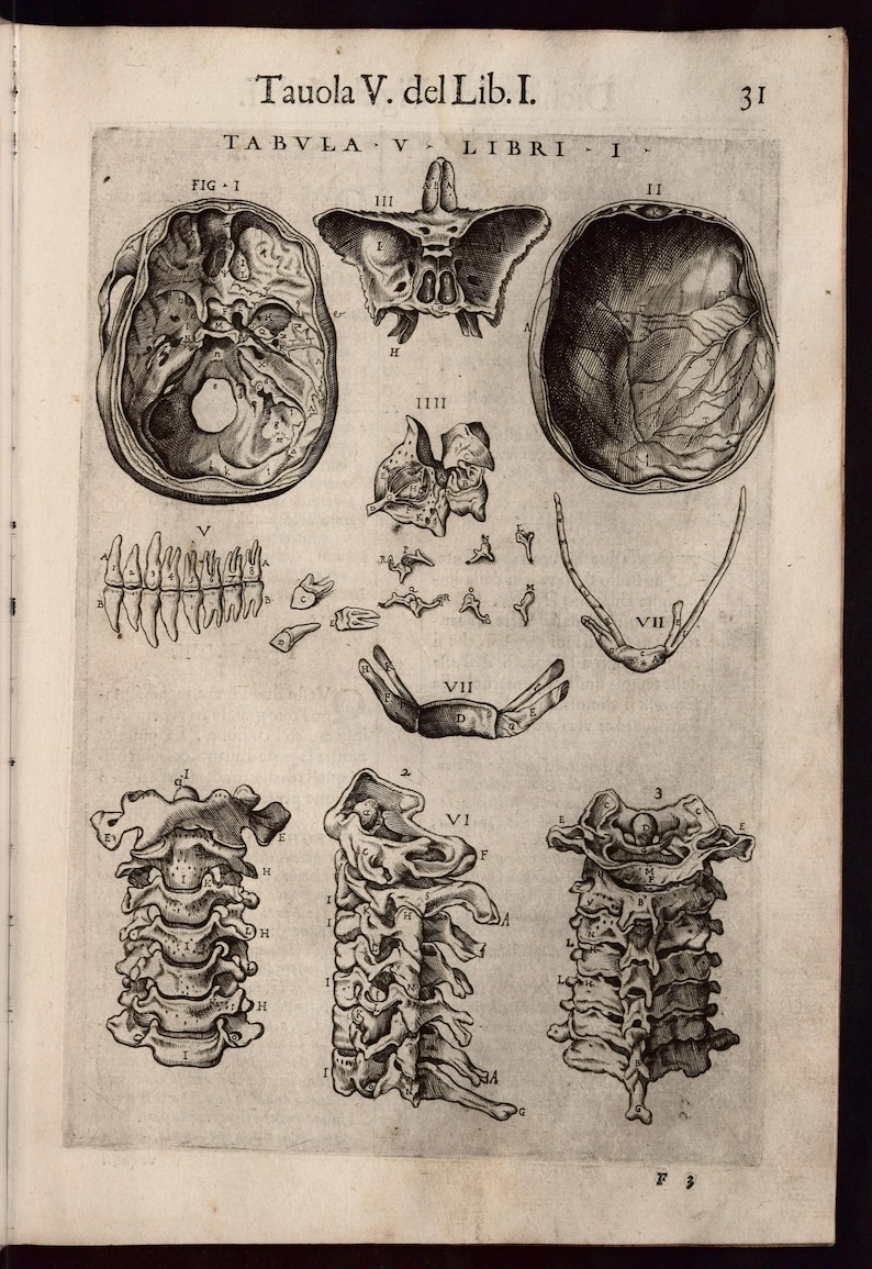 Anatomy of the Human Corpus by Juan Valverde (1586) – Renaissance ...