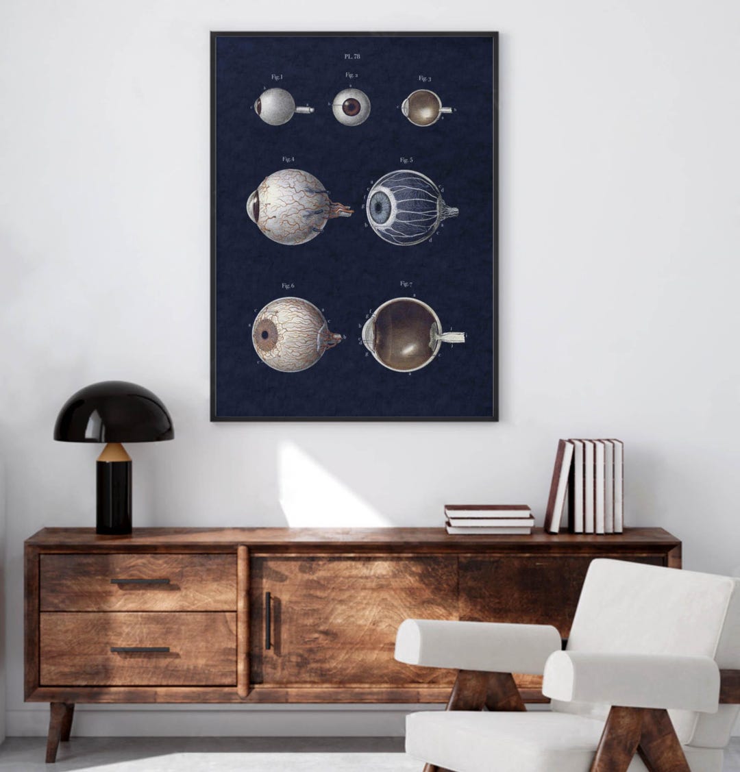 Vintage French Eye Anatomy Print, Antique Eyeballs Poster, Optometry ...