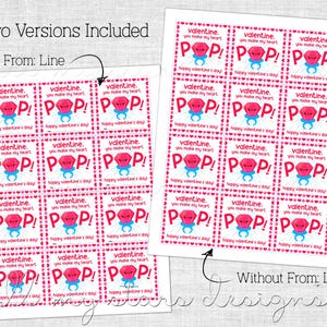 PRINTABLE Valentine, You Make My Heart POP! Ring Lollipop Tag | Instant ...