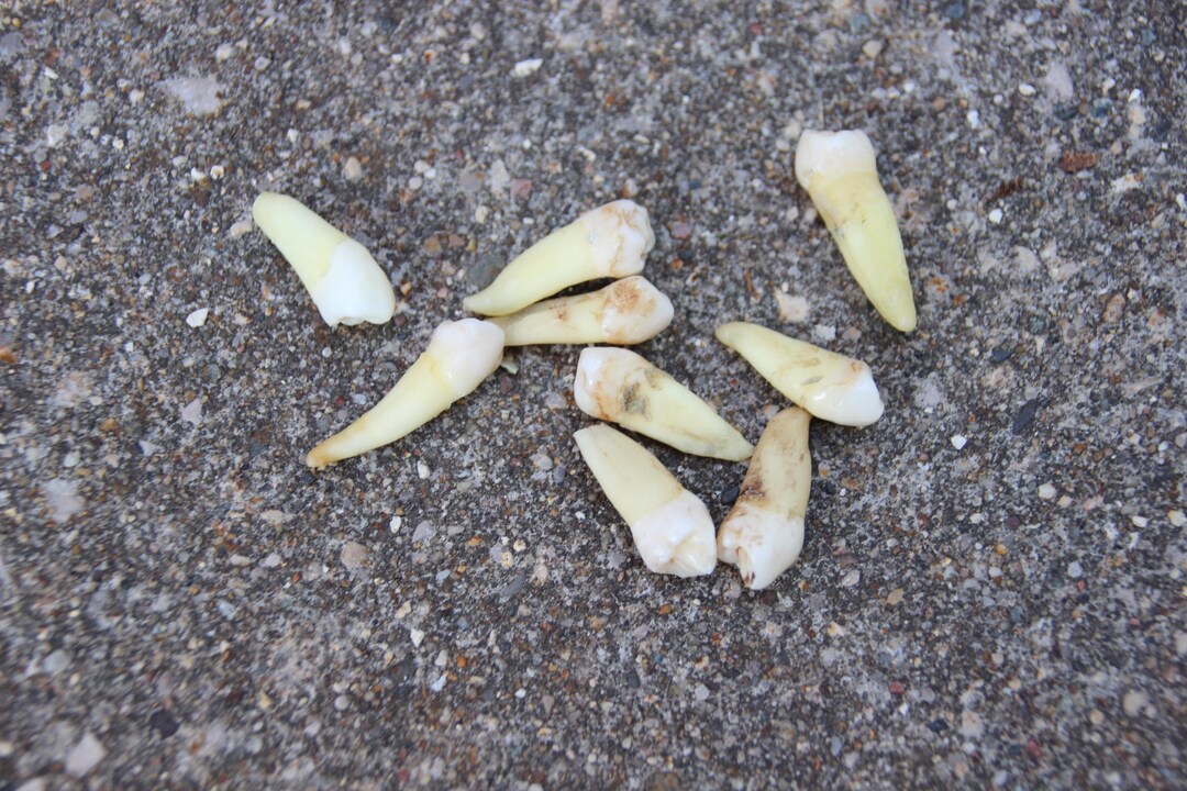 9, Creepy Human Teeth, Dental Teaching Aid, Dental, Creepy Dental ...