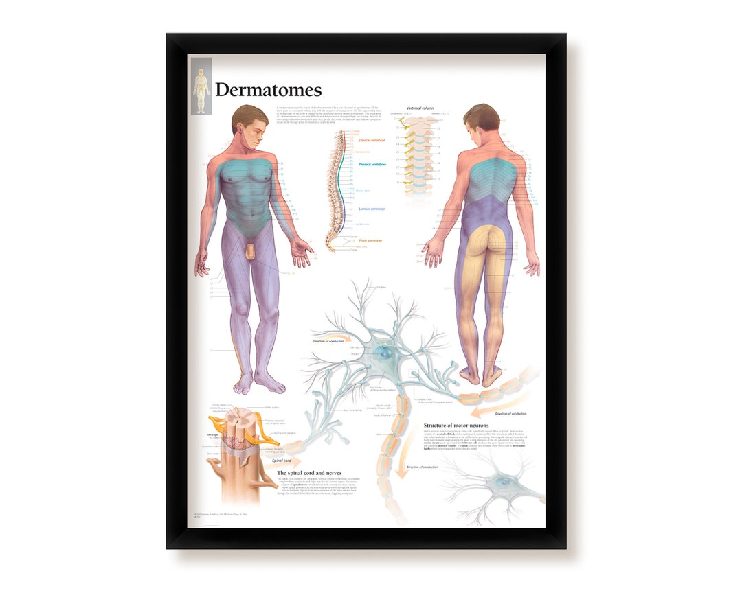 Dermatomes Framed Medical Educational Informational Poster Diagram ...