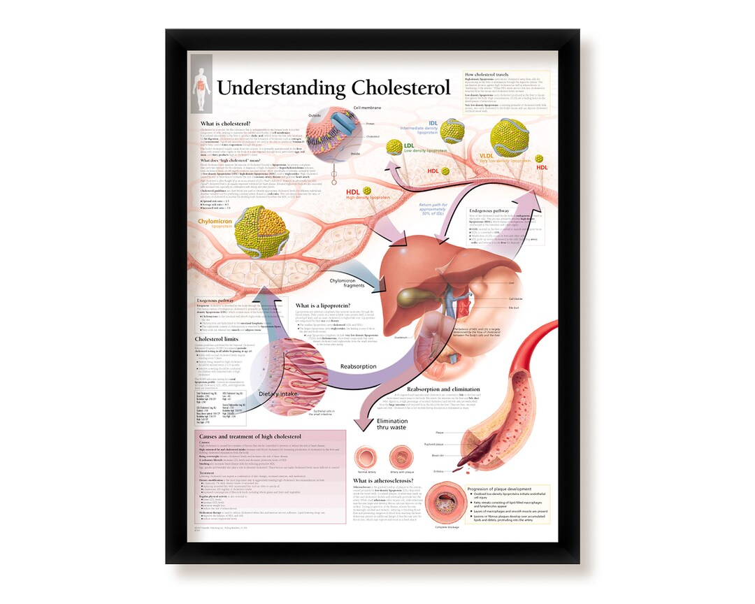 Understanding Cholesterol Framed Medical Educational Informational ...