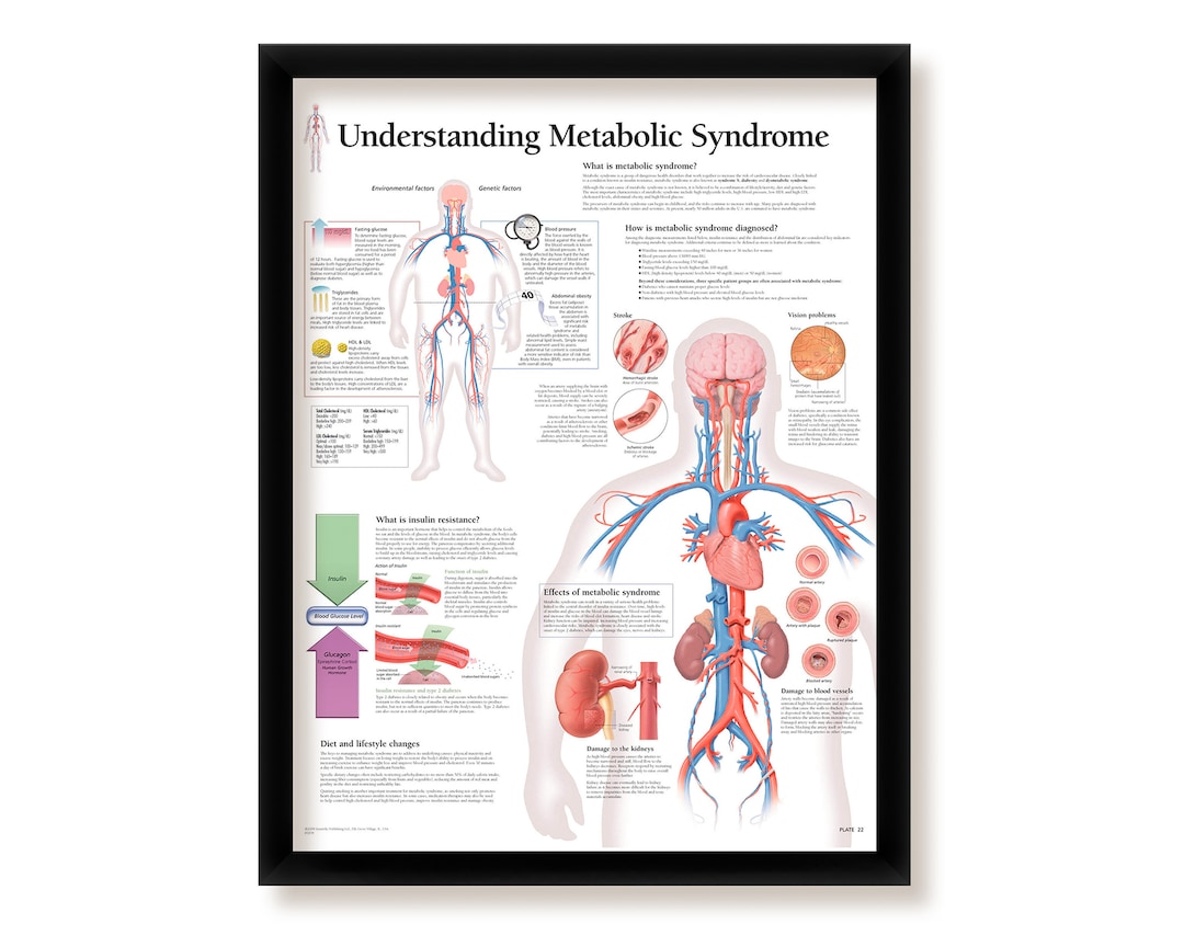 Understanding Metabolic Syndrome Framed Medical Educational ...