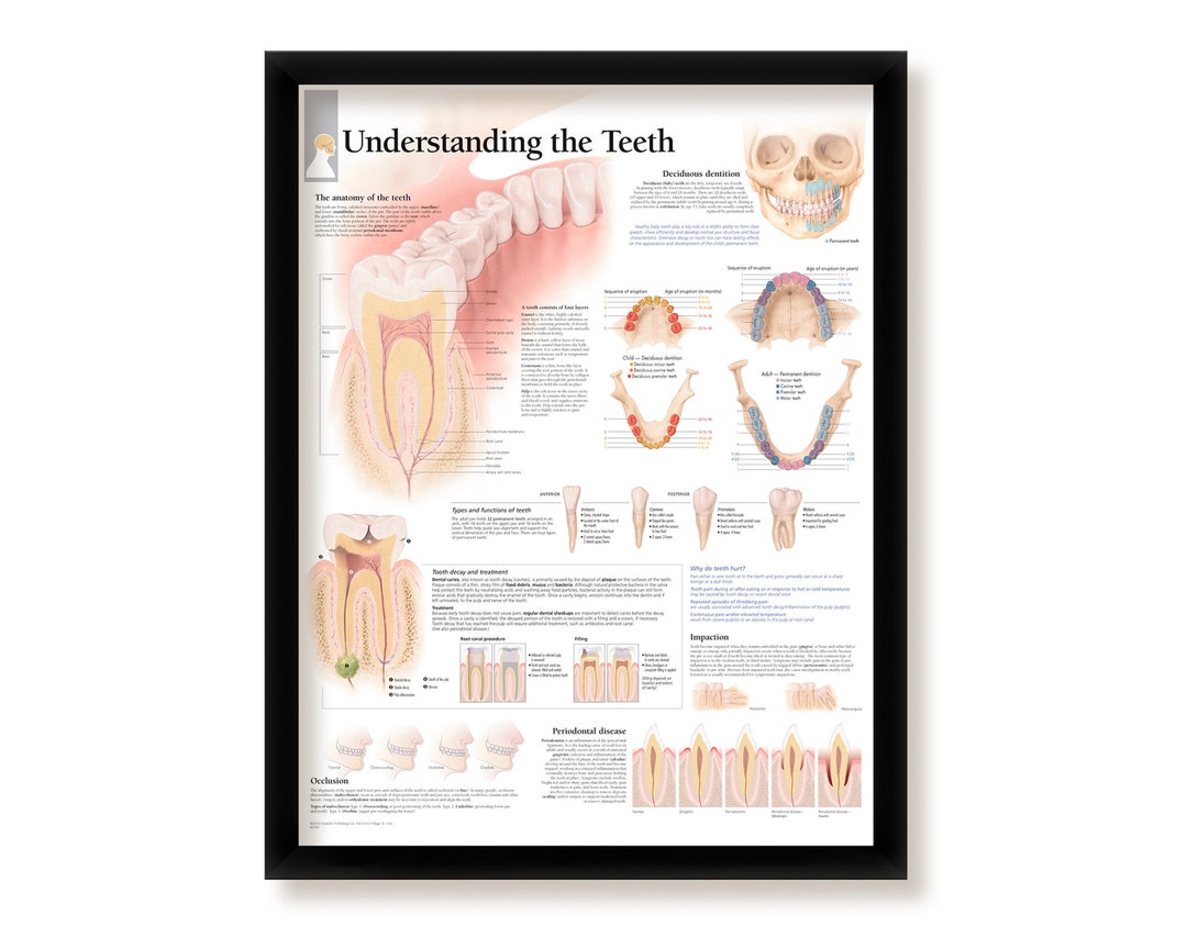 Understanding Teeth, Wall Decor Poster, Framed Educational Art for ...