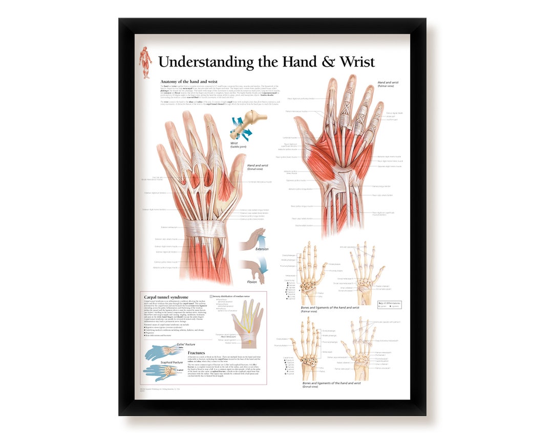 Hand & Wrist Anatomy Framed Medical Poster, Educational Diagram (22x28 ...