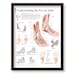 Understanding Sinusitis Medical Educational Informational Poster ...