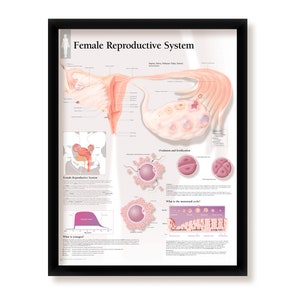 Female Reproductive System Framed Medical Educational Informational ...