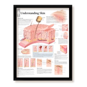 Understanding Skin Framed Medical Educational Informational Poster ...