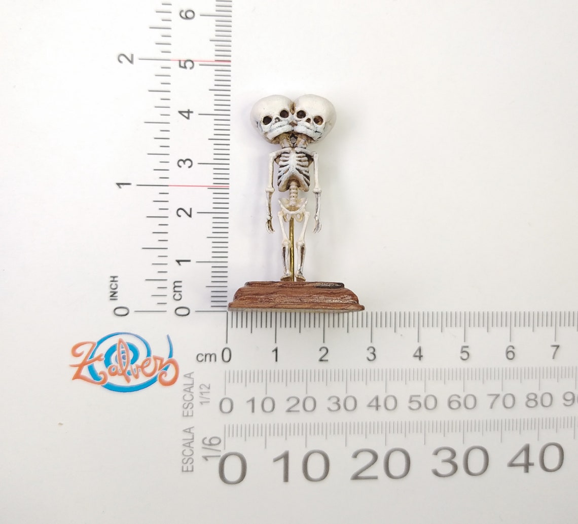CONJOINED TWEENS SKELETON. Dicephalus Parapagus Dipus - Etsy