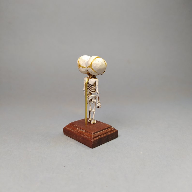 CONJOINED TWEENS SKELETON. Dicephalus Parapagus Dipus - Etsy