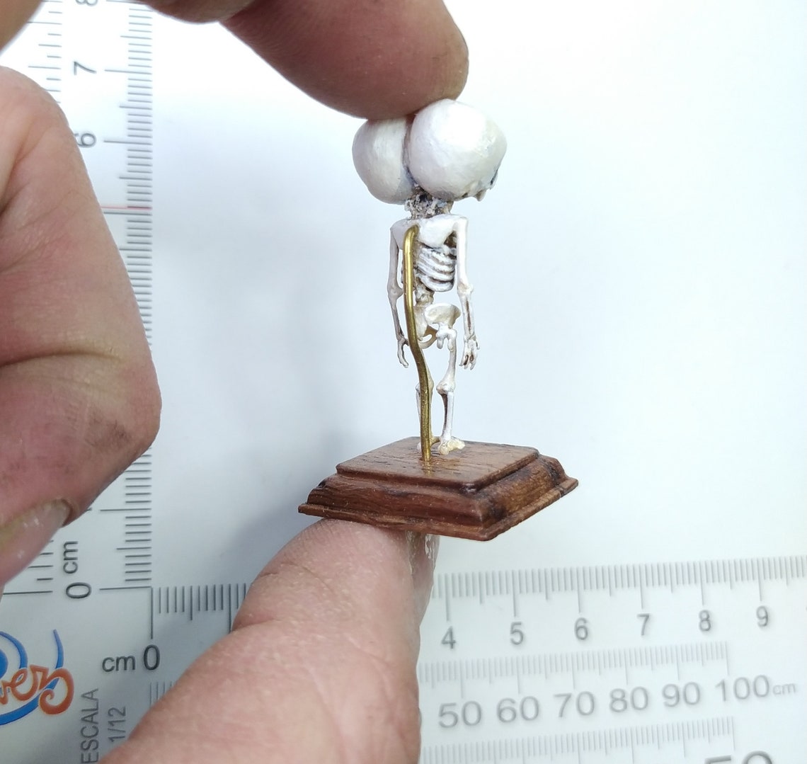 CONJOINED TWEENS SKELETON. Dicephalus Parapagus Dipus - Etsy