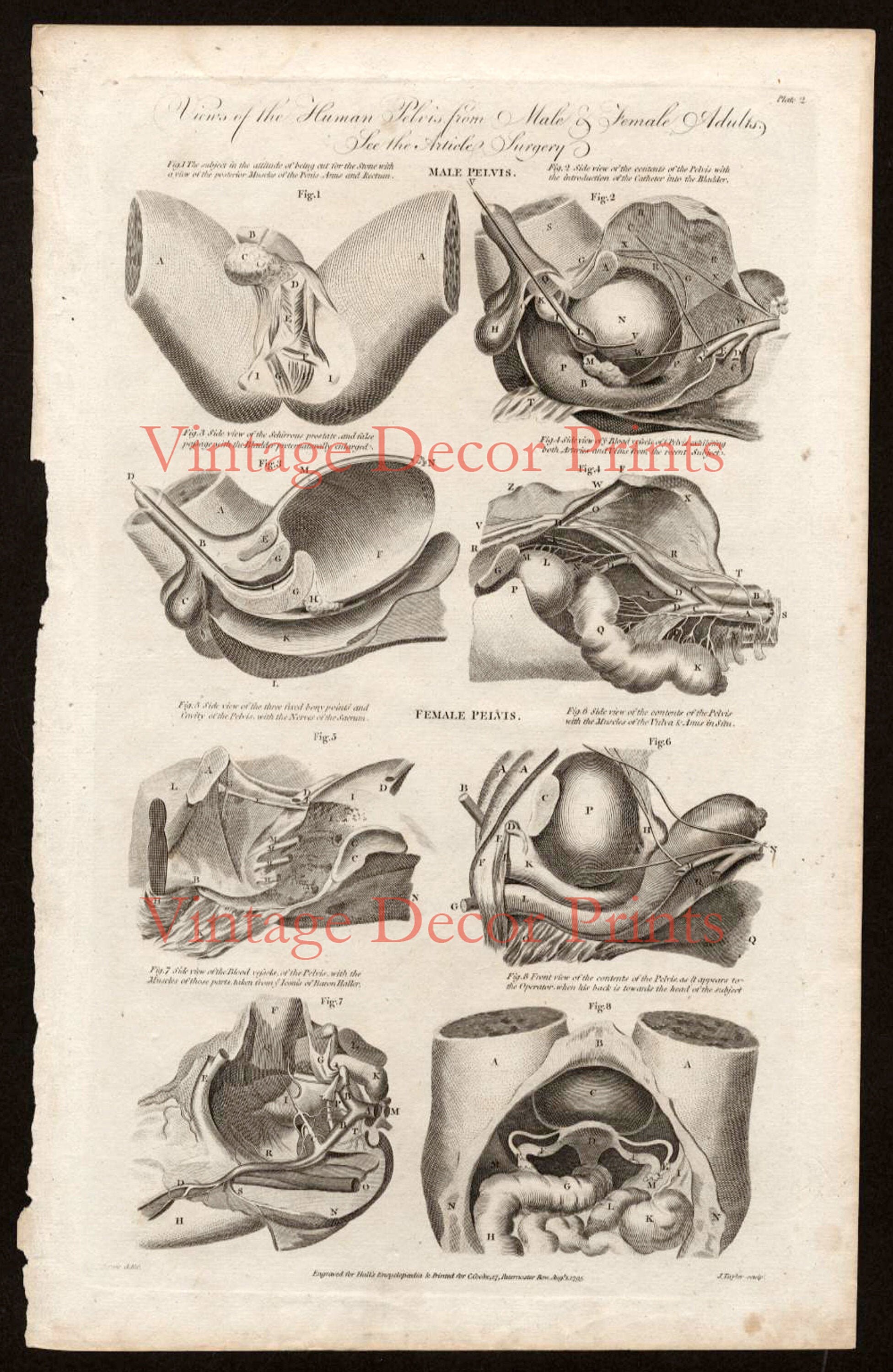 Anatomy Engraving of the Male and Female Pelvis. Date of Engraving 1795 ...