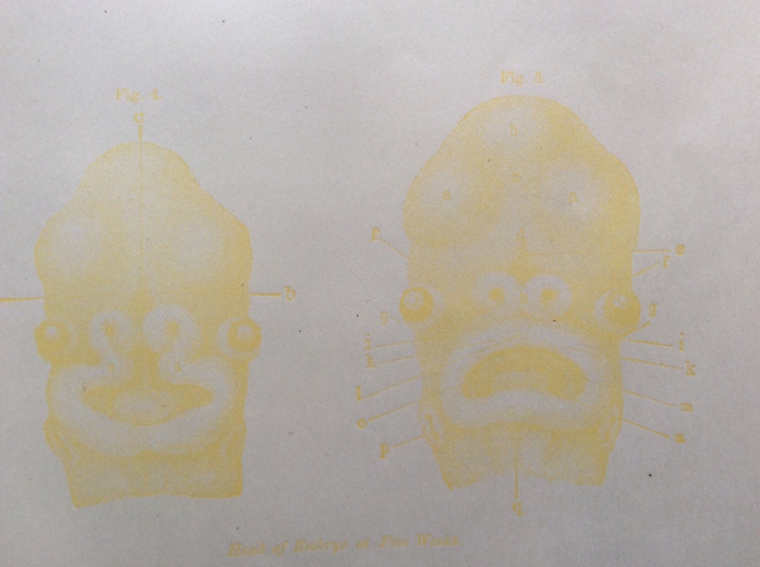 HOMER SIMPSON FOETUS Embryo Antique Print Medical Bookplate Anatomy ...