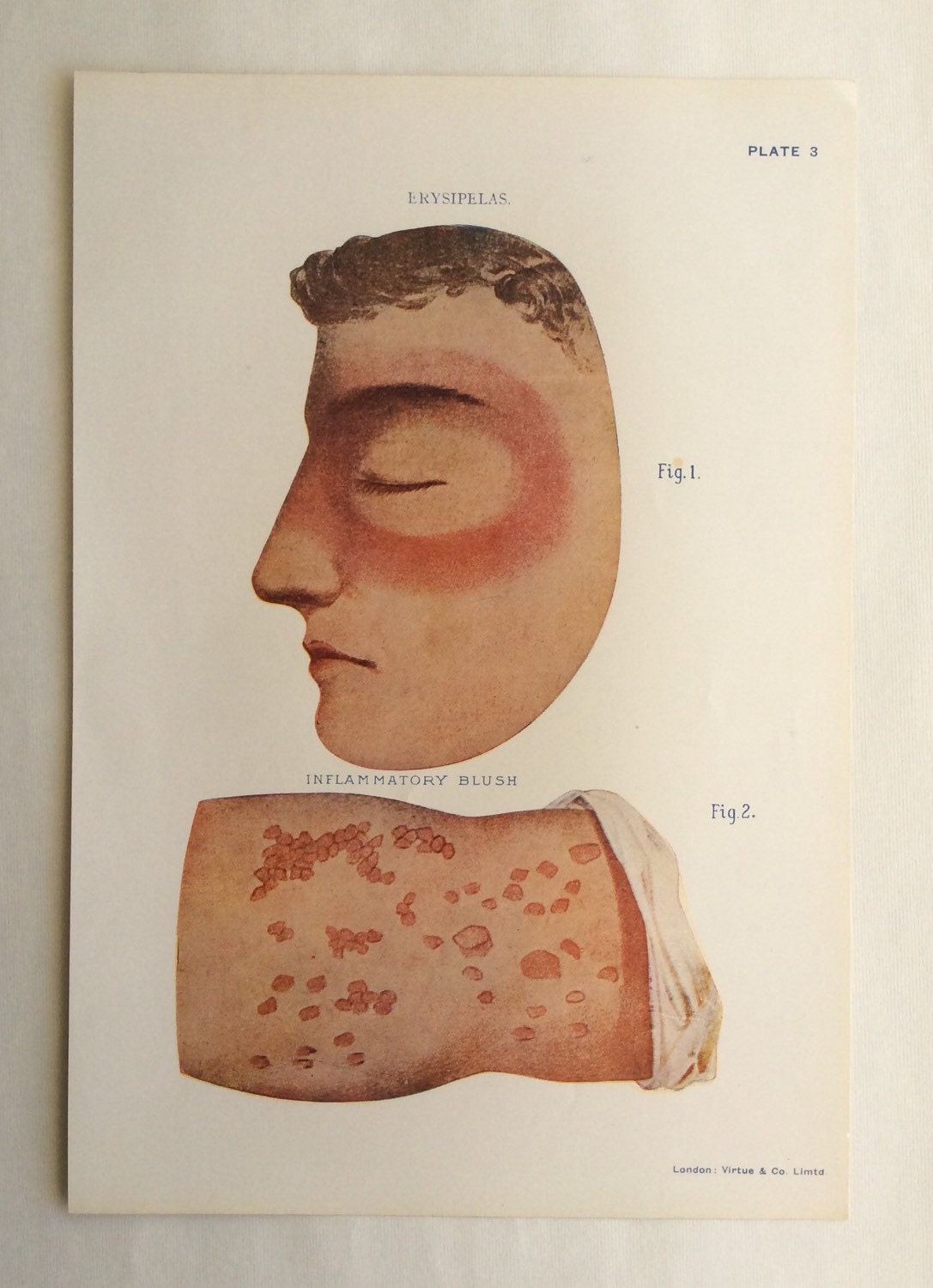 Vintage 1920s Medical Bookplate Print Diagnostic Diagram - Etsy