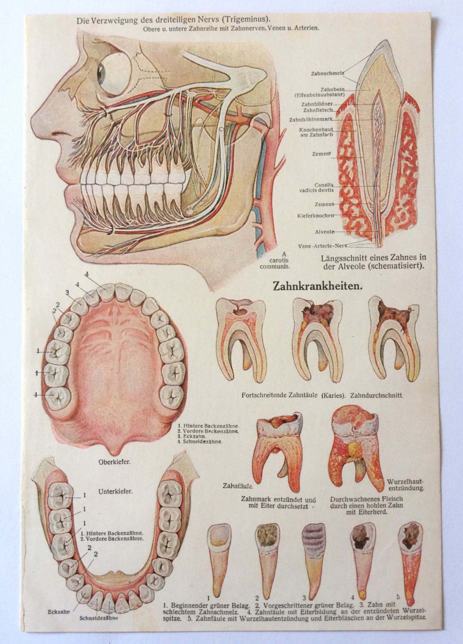 Antique Print 1920s German Anatomy FACE Dissection TOOTH DISEASE Teeth ...