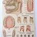 Antique Print 1920s German Anatomy FACE Dissection TOOTH DISEASE Teeth ...