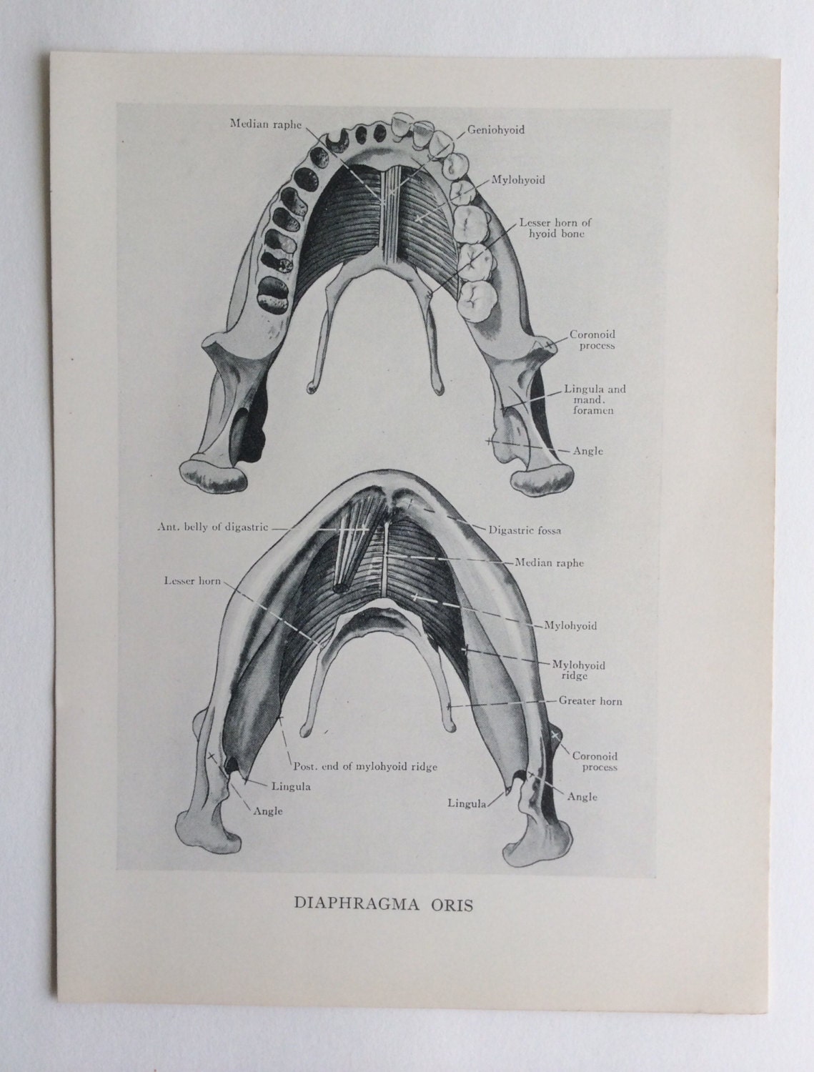 Original Vintage Human Anatomy Dissection Illustration Bookplate Print ...