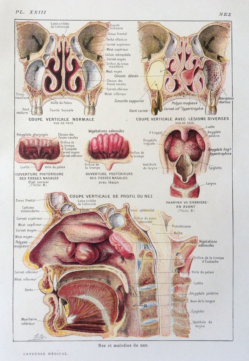 1920s French Human Anatomy Dissection Bookplate NOSE Print Medical ...
