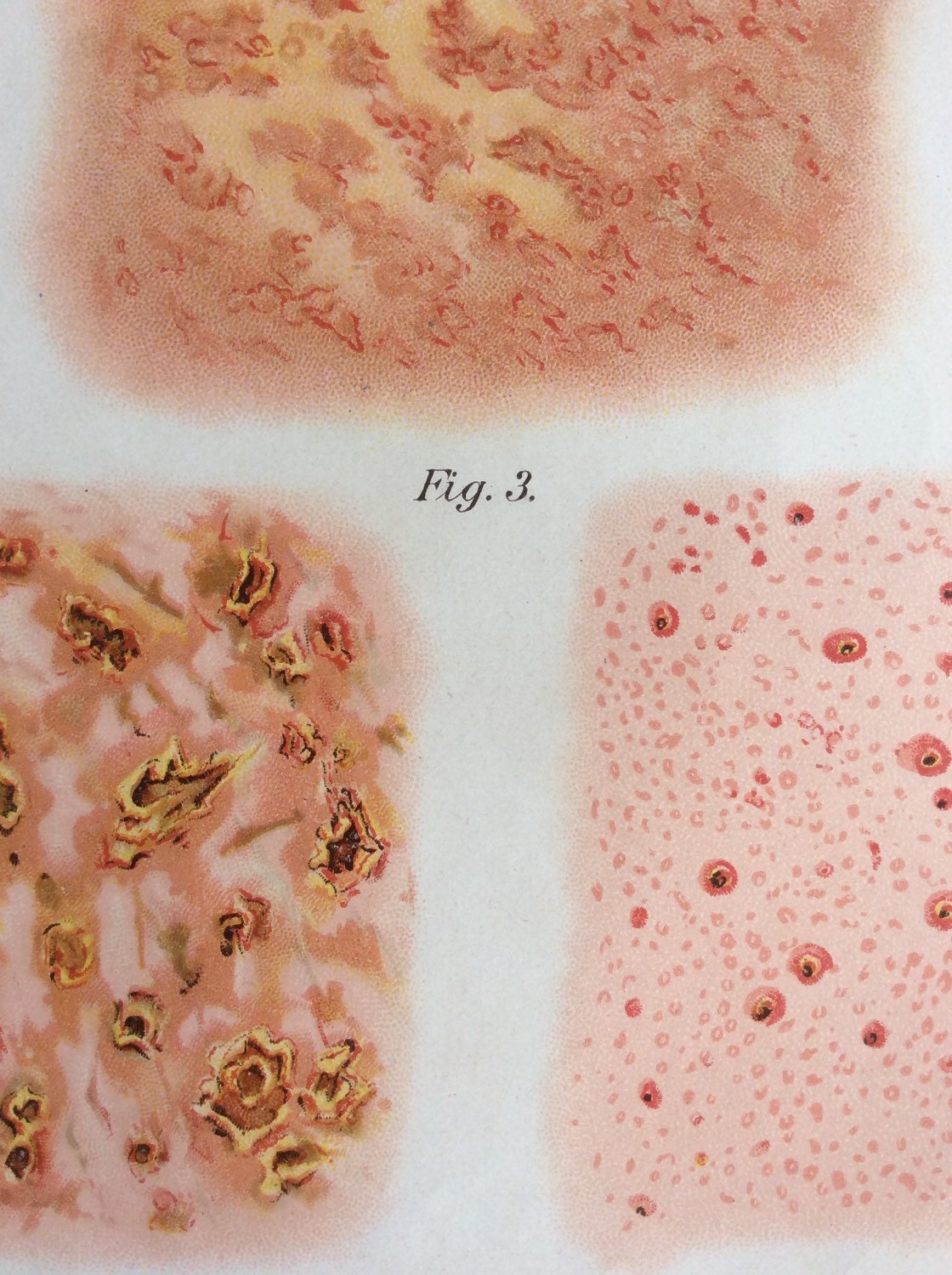 Vintage 1907 German Medical Anatomy Diagram Bookplate Skin Disease ...
