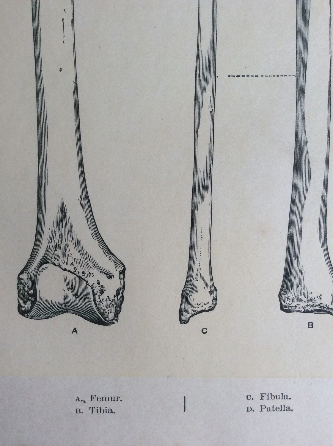 Antique 1890s Medical Anatomy Diagram LEG BONES Skeleton Victorian ...