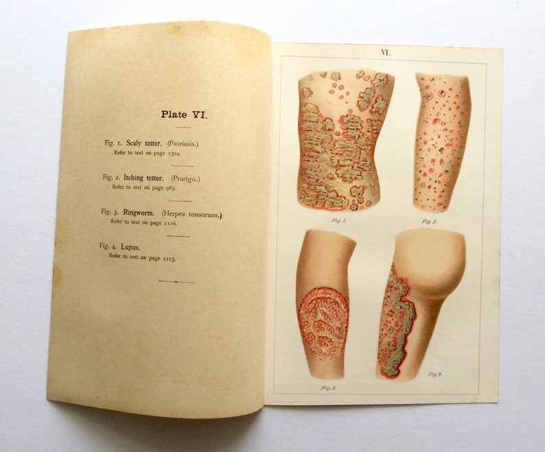 Antique Print Medical Bookplate Anatomy Print 1900s Chromolithograph ...