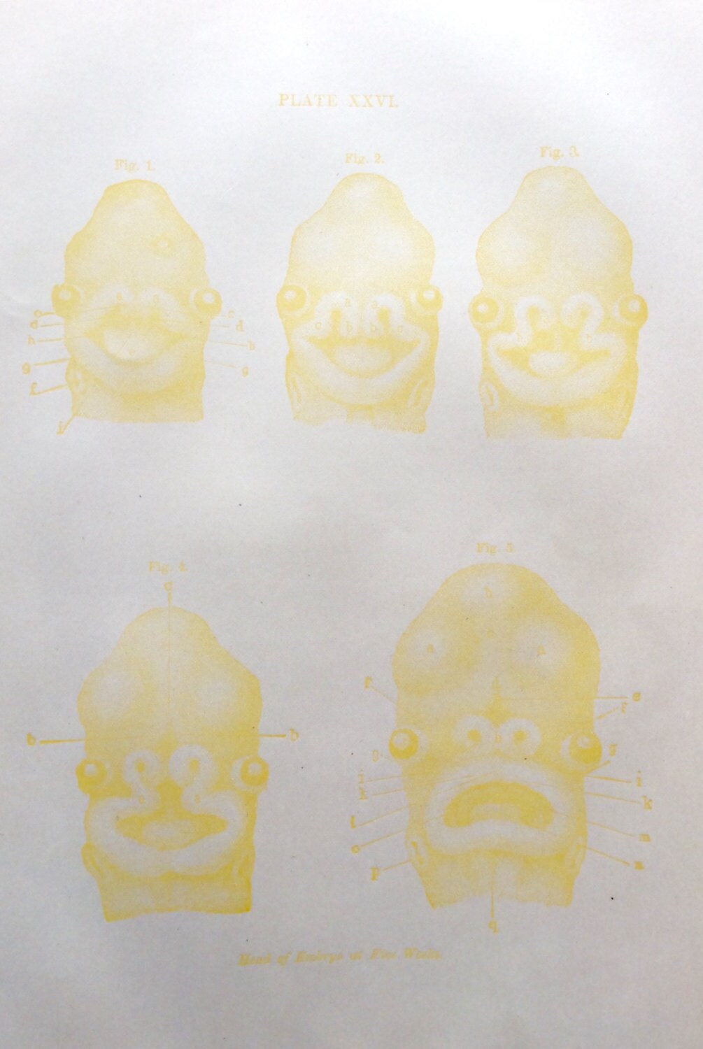 HOMER SIMPSON FOETUS Embryo Antique Print Medical Bookplate Anatomy ...