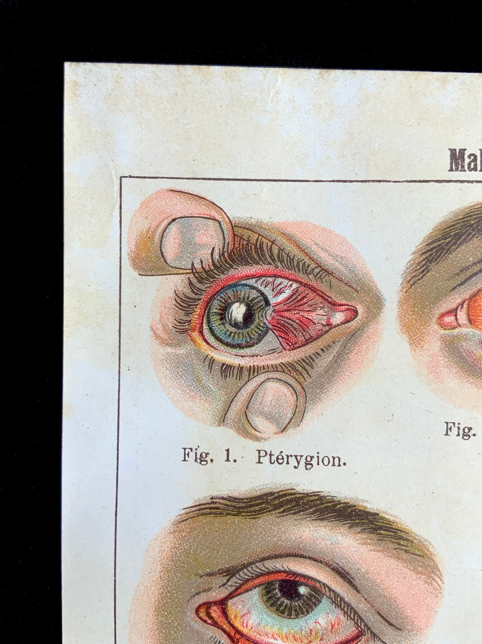 Antique BOSS-EYED Print French Anatomy Bookplate Circa 1900 - Etsy