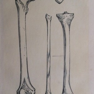Antique 1890s Medical Anatomy Diagram LEG BONES Skeleton Victorian ...