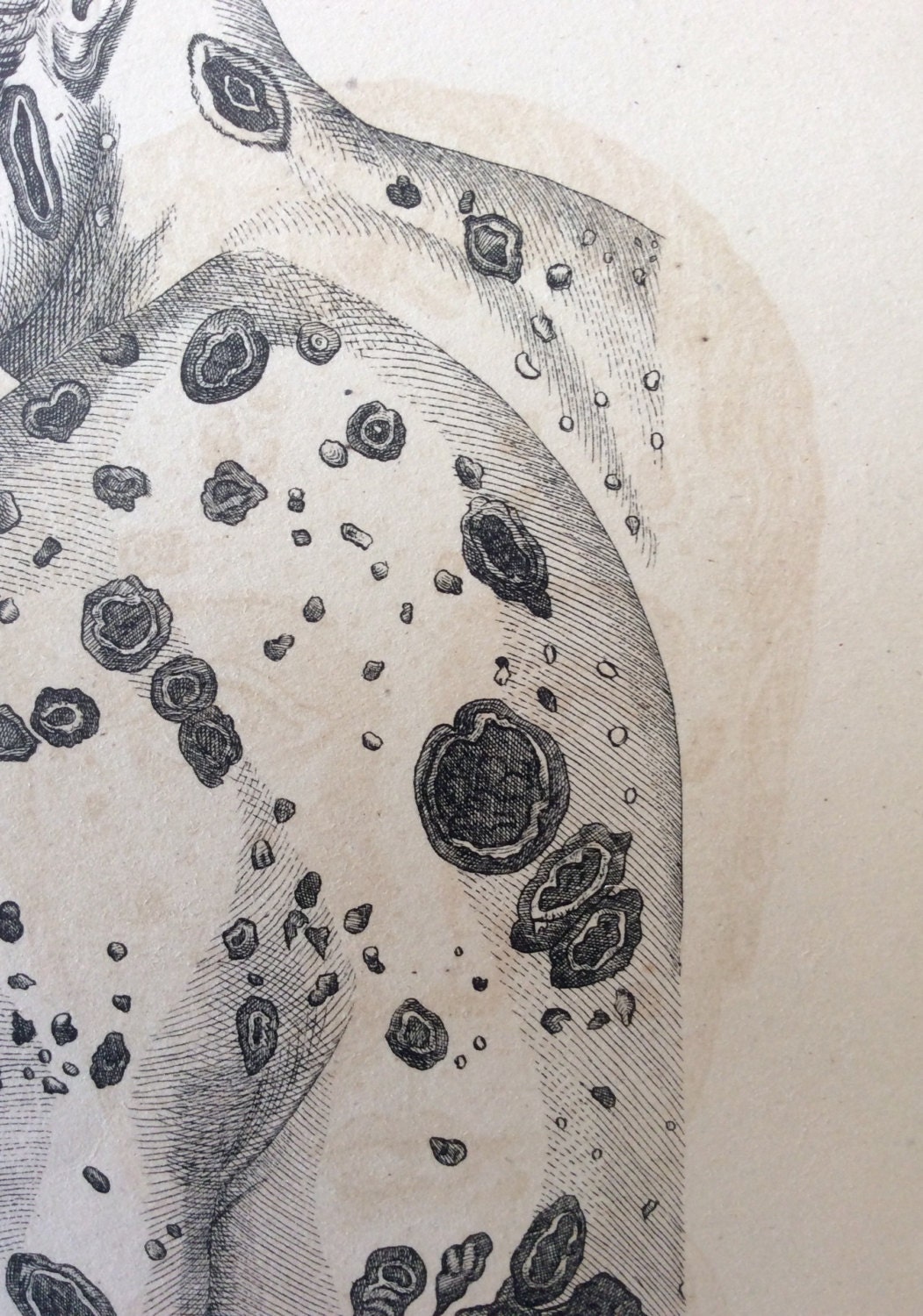Antique Print Engraving Anatomy SKIN DISEASE Bookplate 18th 19th ...