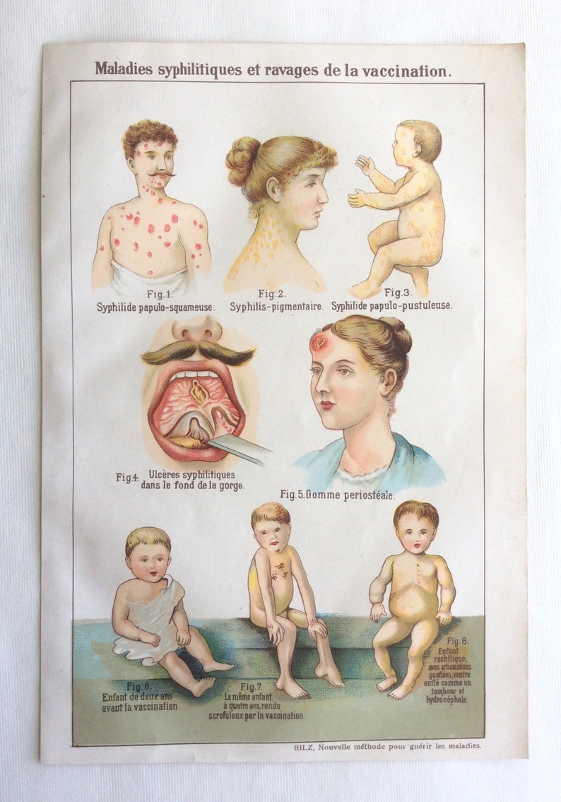 Antique Print French Bookplate Print 1900s SYPHILIS Chromolithograph ...