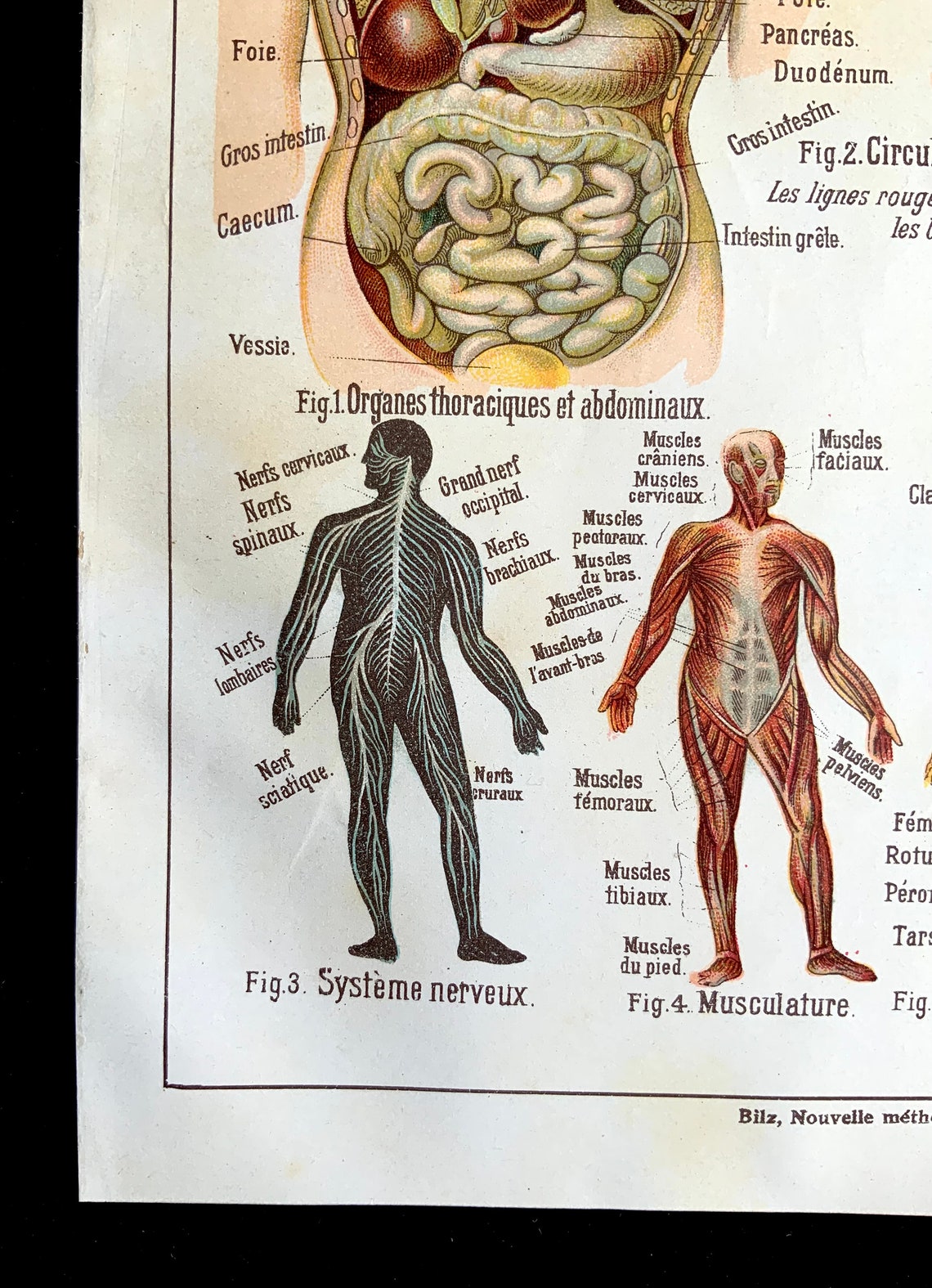 Antique Print French Dissection Anatomy 1900 Chromolithograph | Etsy