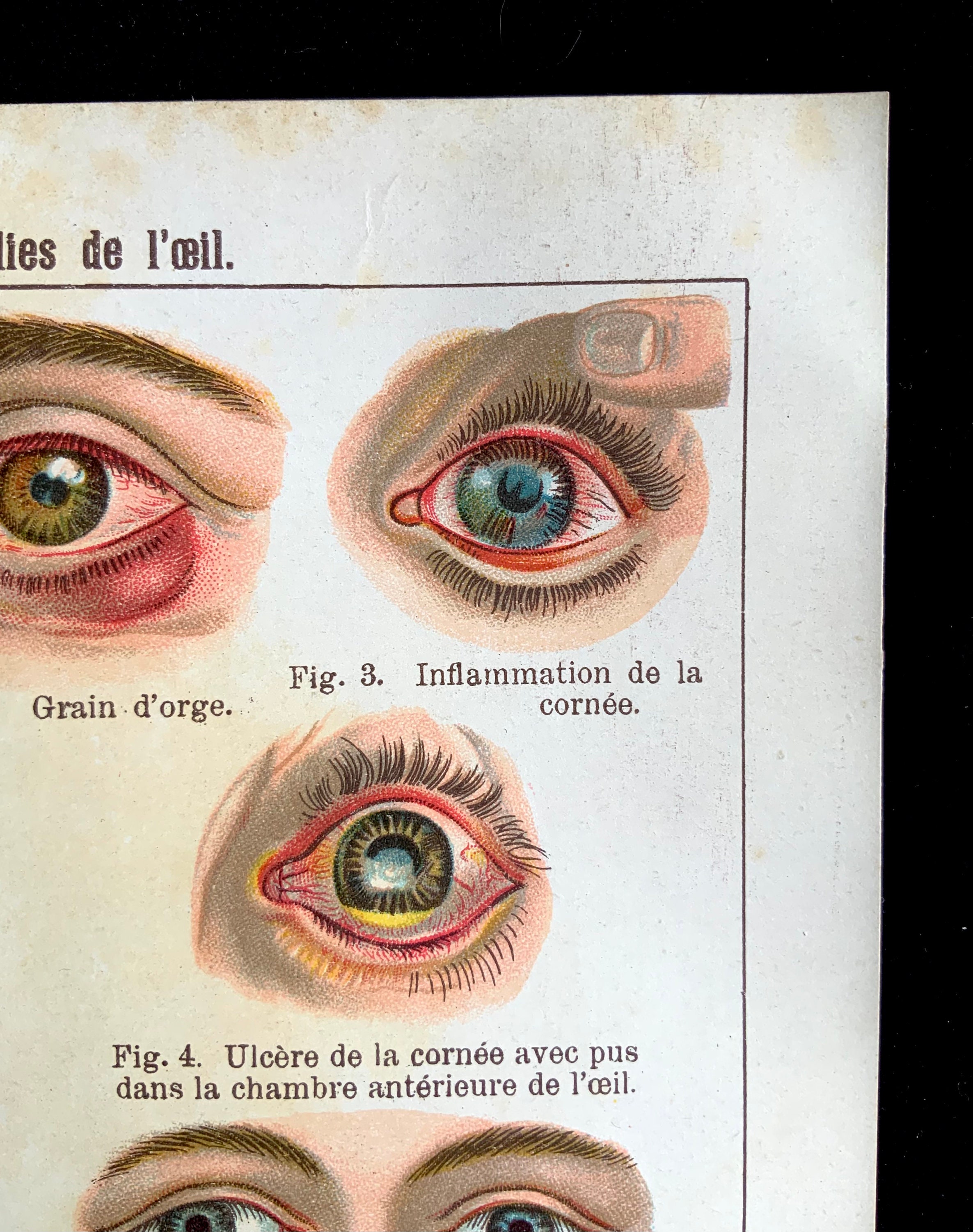 Antique BOSS-EYED Print French Anatomy Bookplate Circa 1900 - Etsy