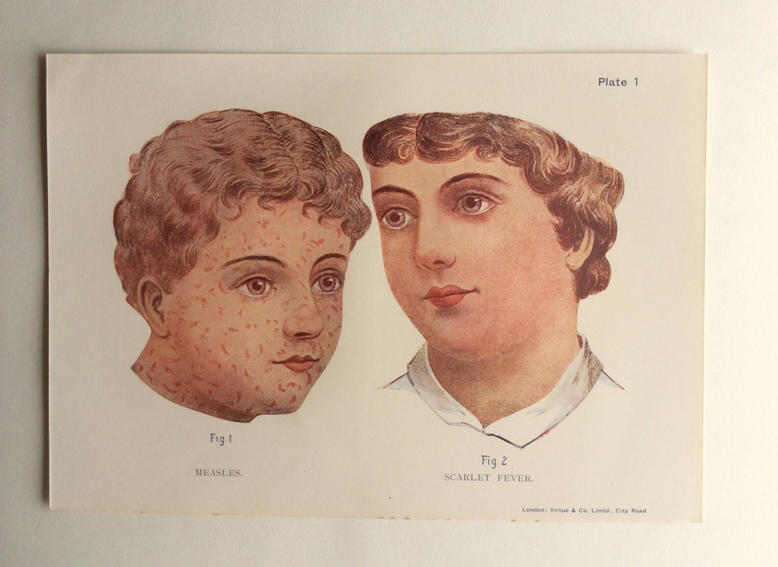 Vintage 1920s Medical Bookplate Print Diagnostic Diagram Disease ...