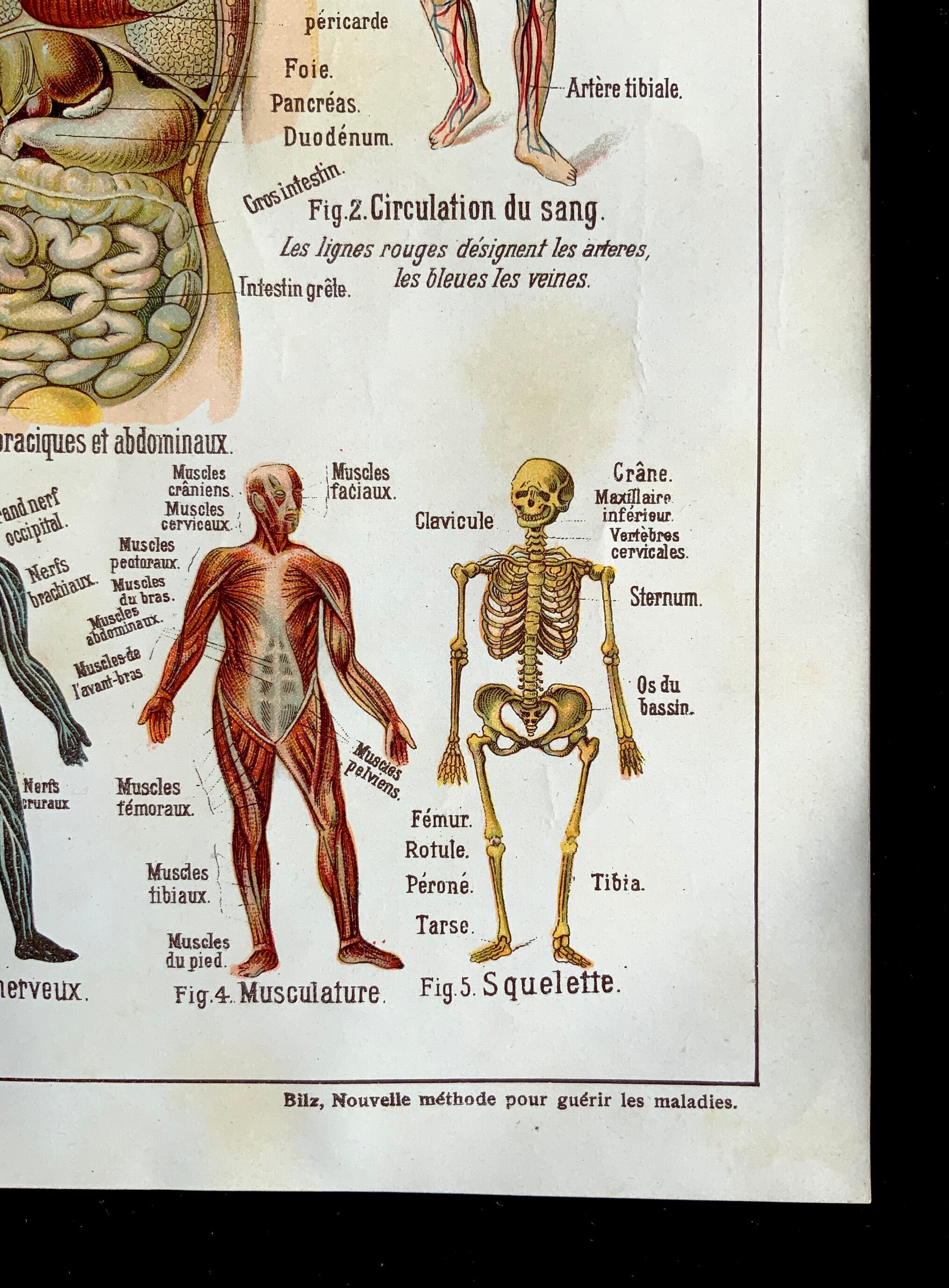 Antique Print French Dissection Anatomy 1900 Chromolithograph Medical ...