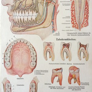 Antique Print 1920s German Anatomy FACE Dissection TOOTH DISEASE Teeth ...