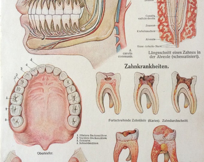 Antique Print 1920s German Anatomy FACE Dissection TOOTH DISEASE Teeth ...