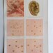 Antique Print Anatomy Bookplate Chromolithograph Small Pox Disease ...